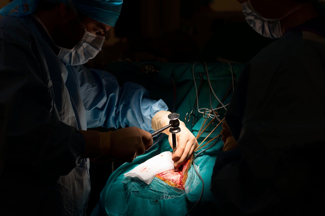 Most expensive medical procedures in the U.S., without insurance