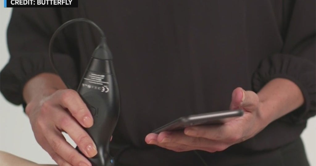 Study: Ultrasound Scanner Can Help Improve Diagnostic COVID Accuracy ...