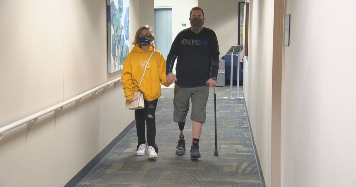 Permanent Prosthesis Allows Father To Walk While Holding Hands With ...