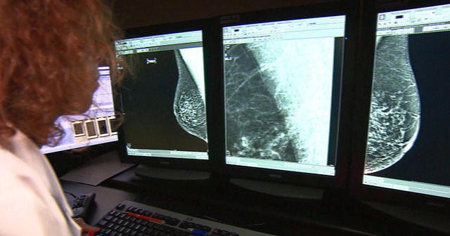 New guidelines recommend mammograms begin at age 50 - CBS News