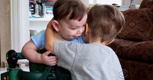 Mother speaks out about young son living with microcephaly - CBS News