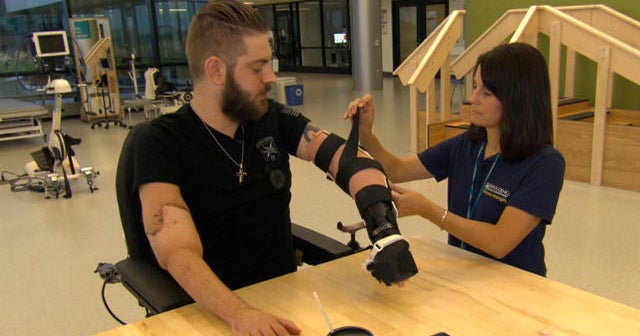 Afghanistan veteran debuts double arm transplant - CBS News