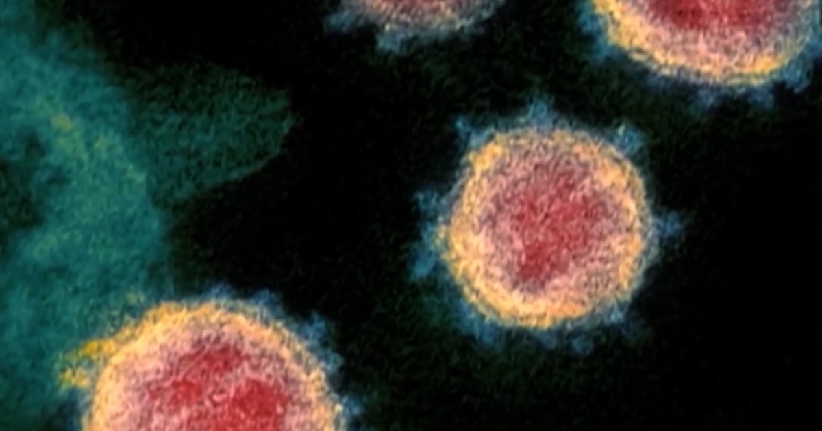 CDC: Delta Variant As Contagious As Chickenpox - CBS Miami