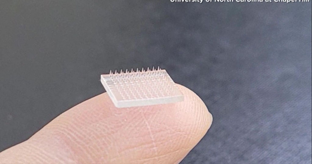 Researchers Developing Patch To Replace Painful Vaccine Shots - CBS Miami