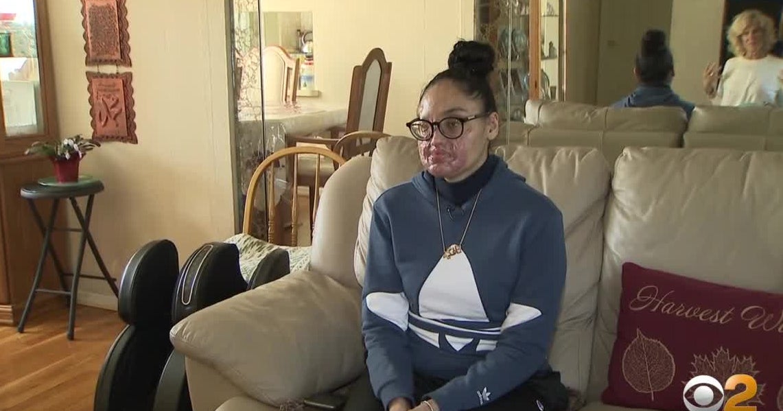 FBI Doubles Reward For Information In Acid Attack On Hofstra Student ...