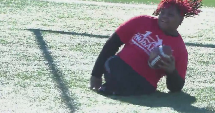 Missing Limbs Not Stopping Kids From Participating In Sports, Learning ...