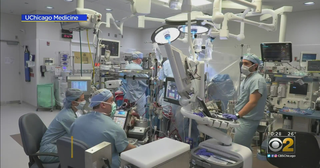 University Of Chicago Medicine Performs 2 Heart Transplants This ...