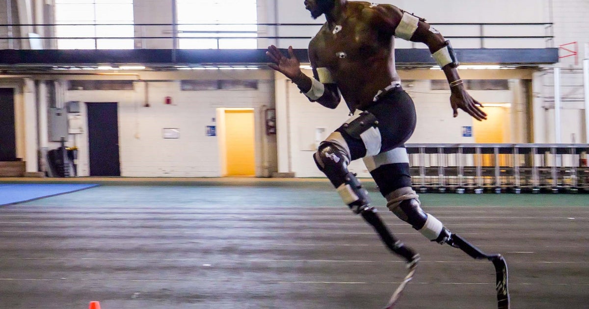 CU Study: 'Blade Runner' Prosthesis Gives Amputee Sprinters No Clear ...