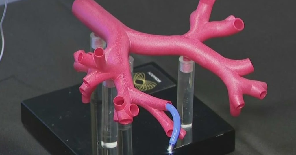 Memorial Cancer Institute Unveils New Tool In Fight Against Lung Cancer ...