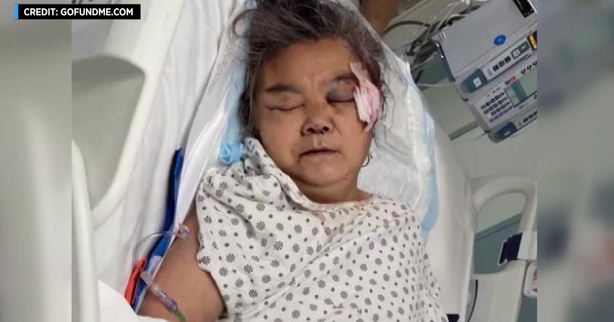 GuiYing Ma, attacked with a rock while sweeping friend's sidewalk in ...