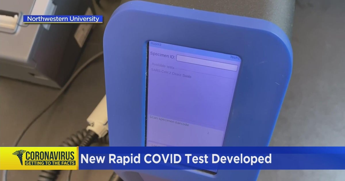 New rapid PCR COVID test receives FDA emergency use authorization - CBS ...