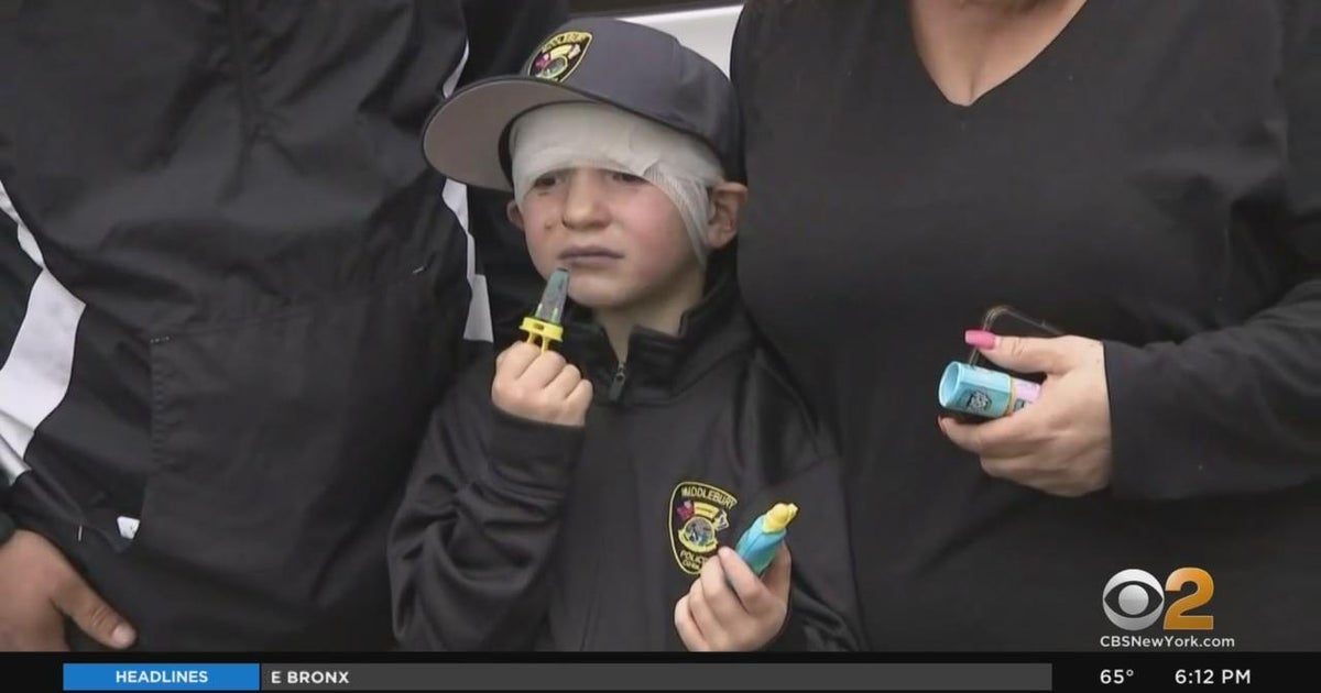 Connecticut boy released from hospital after being burned on legs, face ...