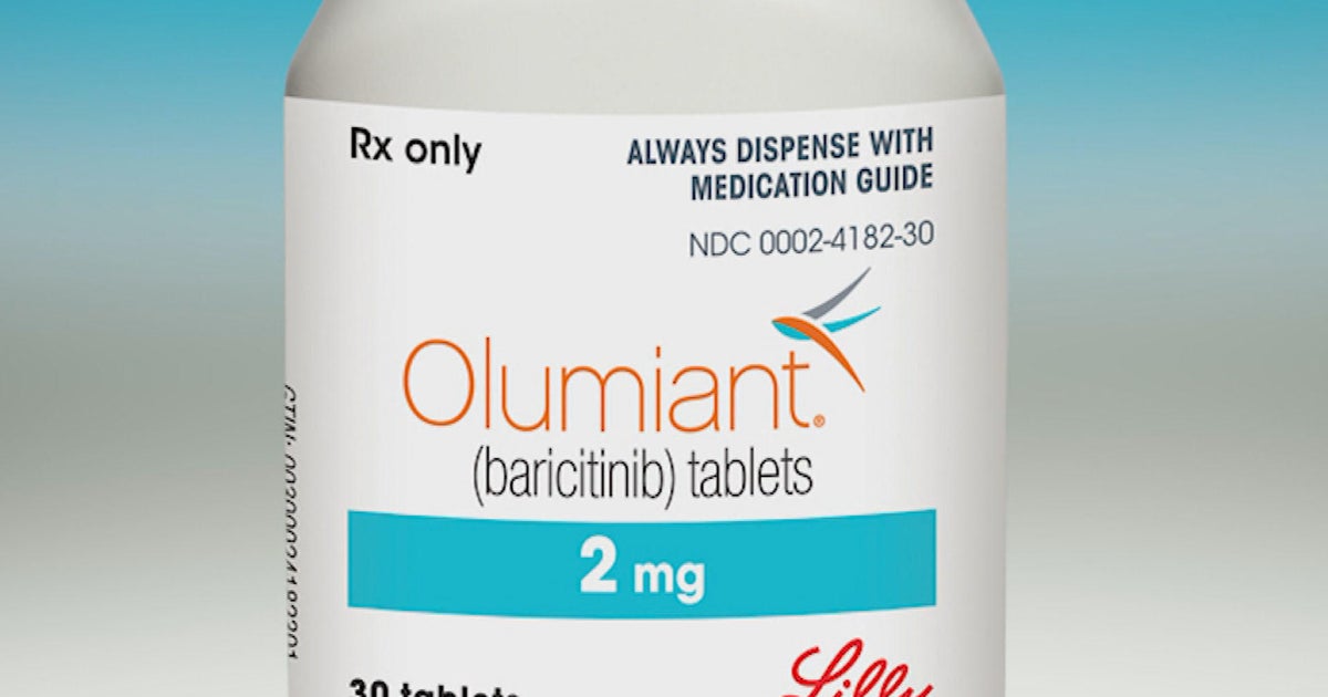 FDA approves first treatment for alopecia - CBS Boston