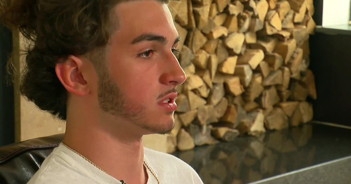 Teen gets new look on life after drug overdose - CBS Minnesota