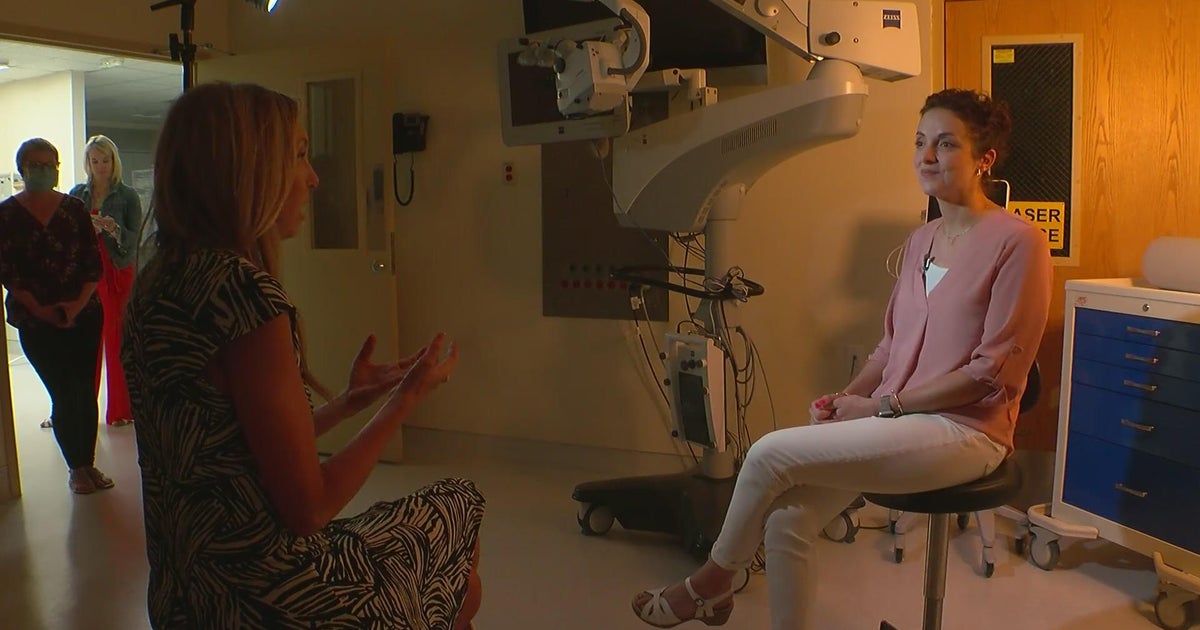 Permanent contact lenses? A new procedure shows promise - CBS Minnesota