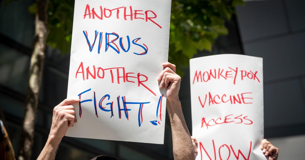 San Francisco issues monkeypox state of emergency; New York state ...