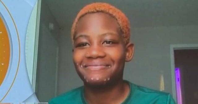 Georgia woman diagnosed with monkeypox talks about her symptoms and ...