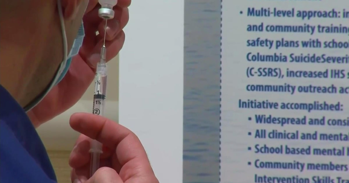 Chicago outlines public health plan for monkeypox outbreak - CBS Chicago