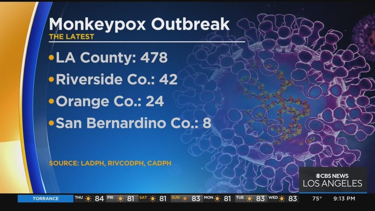 LA County devoting emergency resources to distributing monkeypox ...