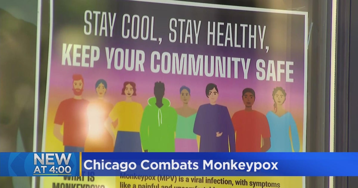 Protecting against monkeypox ahead of Market Days festival - CBS Chicago