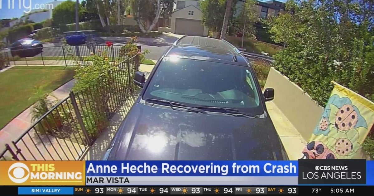 Actress Anne Heche in a medically induced coma after Mar Vista crash ...