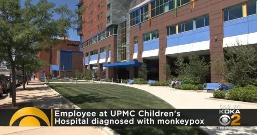 UPMC Children's Hospital employee diagnosed with monkeypox - CBS Pittsburgh
