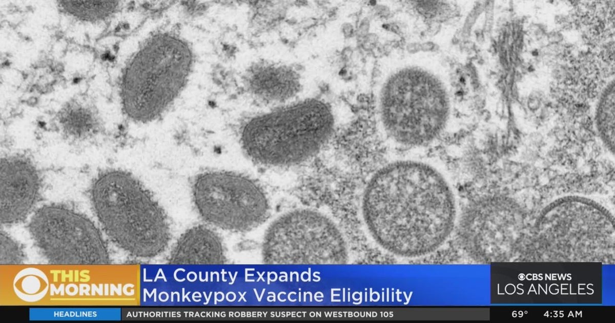 LA County expands Monkeypox vaccine eligibility - CBS Los Angeles
