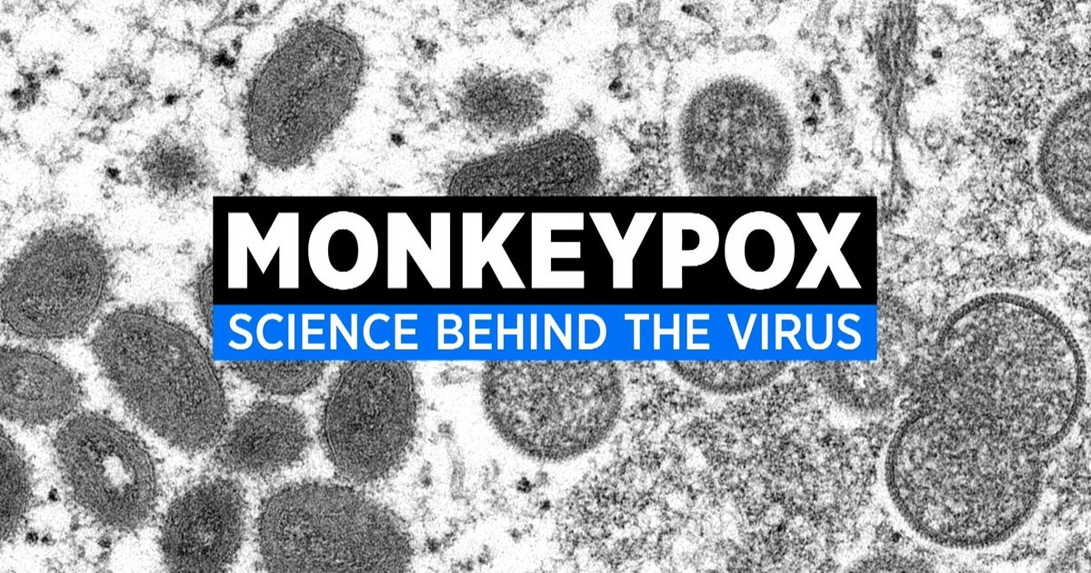 Everything you need to know about monkeypox - CBS Chicago