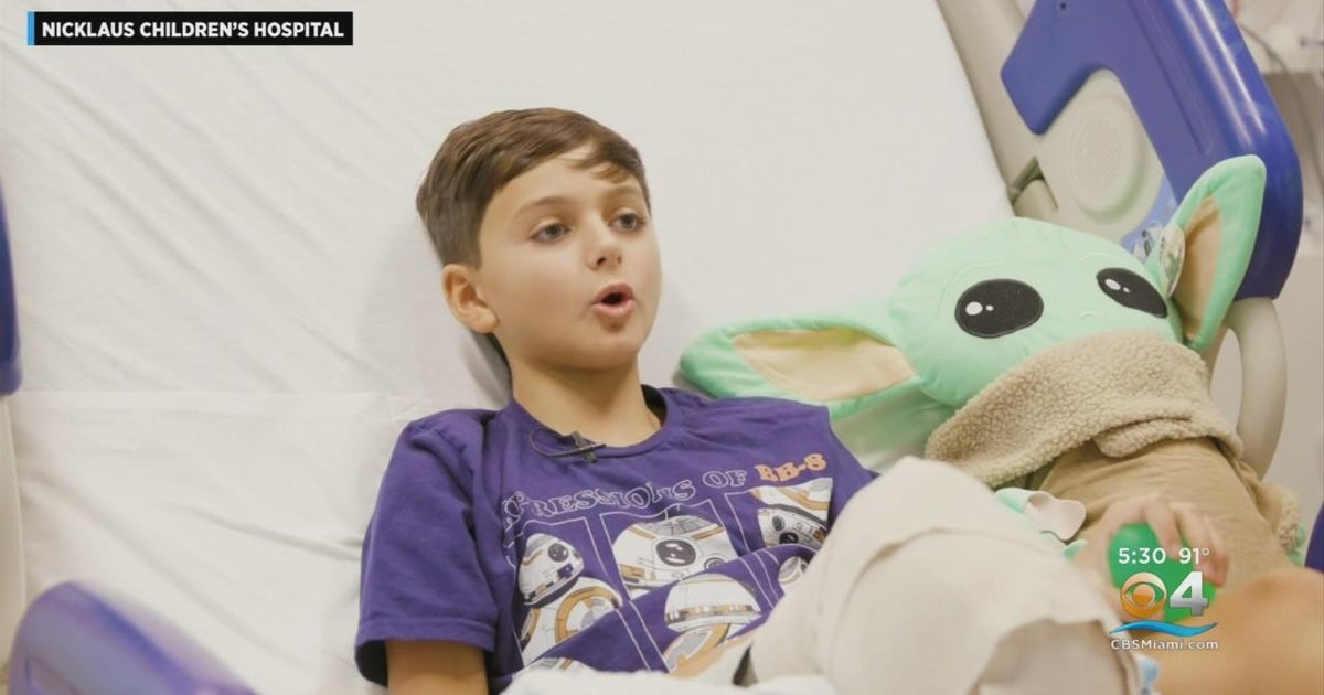 Young boy shares story after shark attack in The Keys - CBS Miami