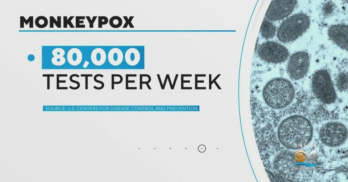 Monkeypox: Infectious disease experts testify in Washington - CBS Miami