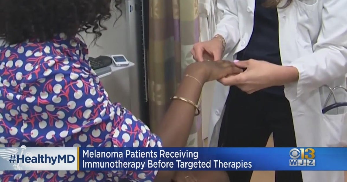 HealthyMD: Melanoma Patients Receiving Immunotherapy Before Targeted ... HealthyMD: Melanoma Patients Receiving Immunotherapy Before Targeted ...