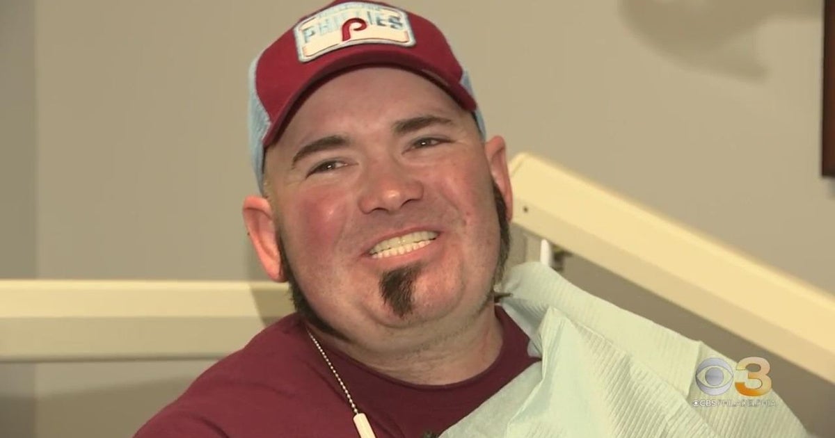 Philadelphia man gets new, free smile following car accident - CBS ...