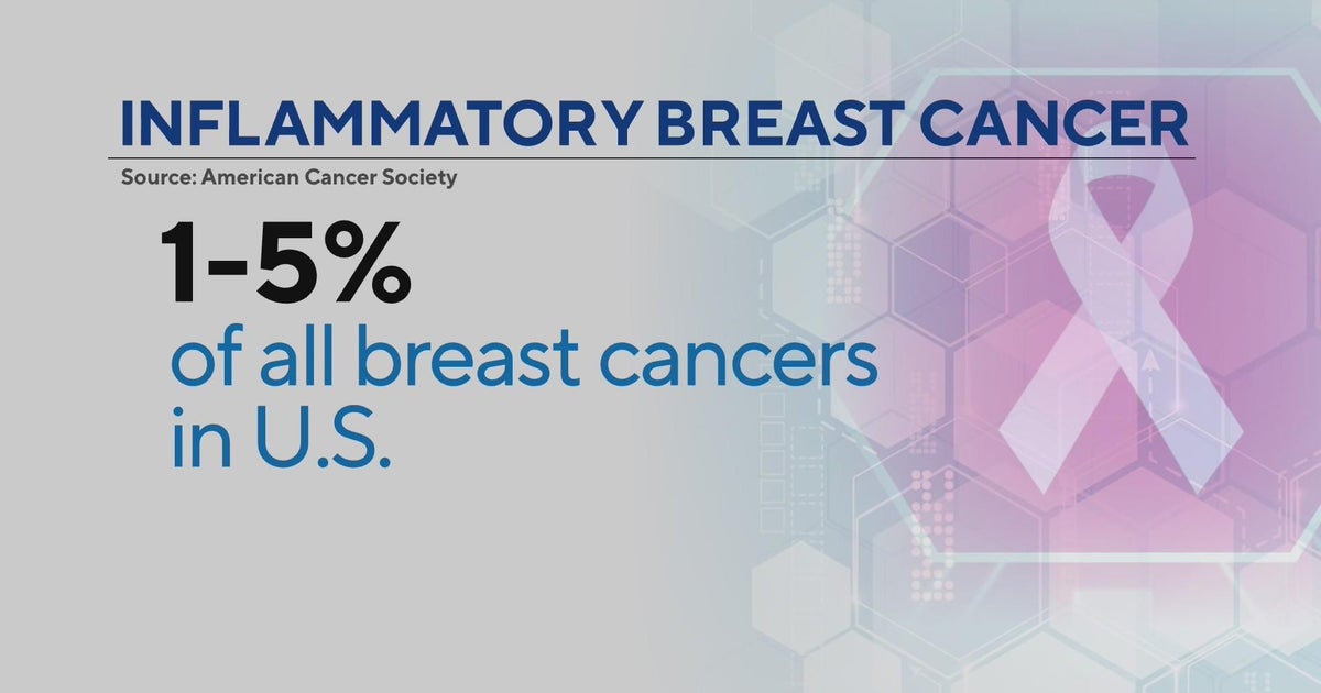 Most women not award of signs of rare type of breast cancer, survey ...