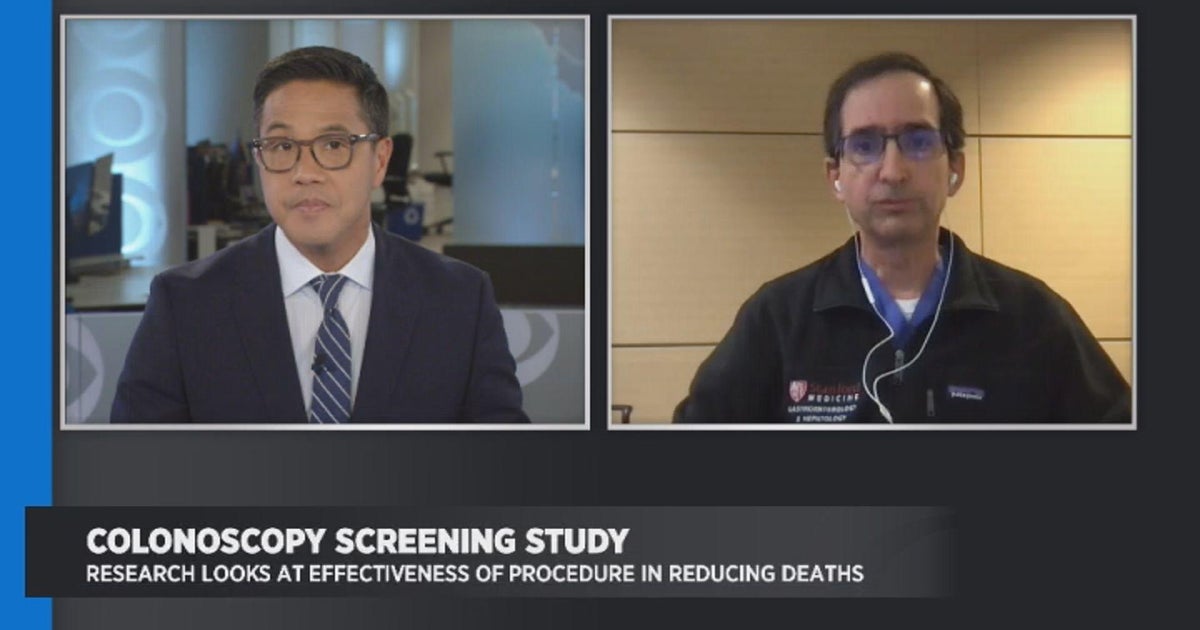 New study of colonoscopy screening - CBS San Francisco