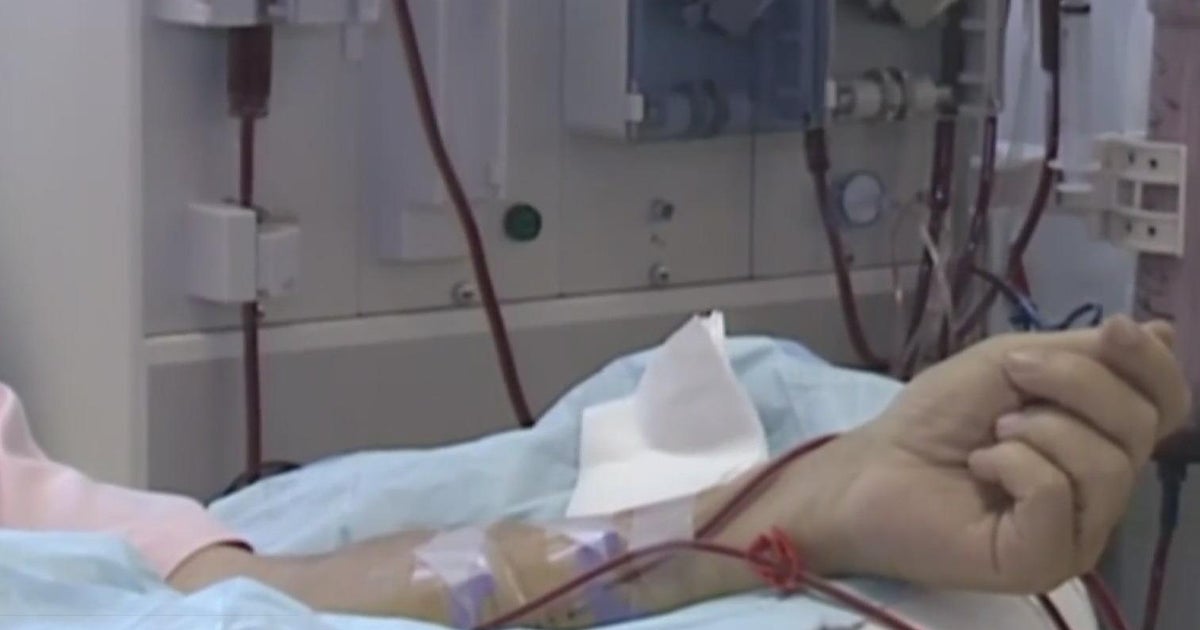 Prop 29 explained ahead of the November election - CBS Sacramento