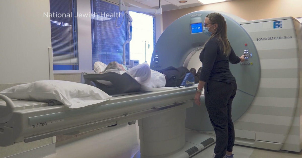 Cancer survivor credits National Jewish for early detection - CBS Colorado