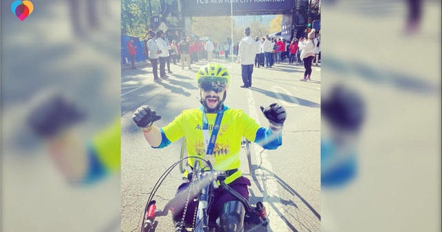 Man who lost his legs after falling onto subway tracks prepares for ...