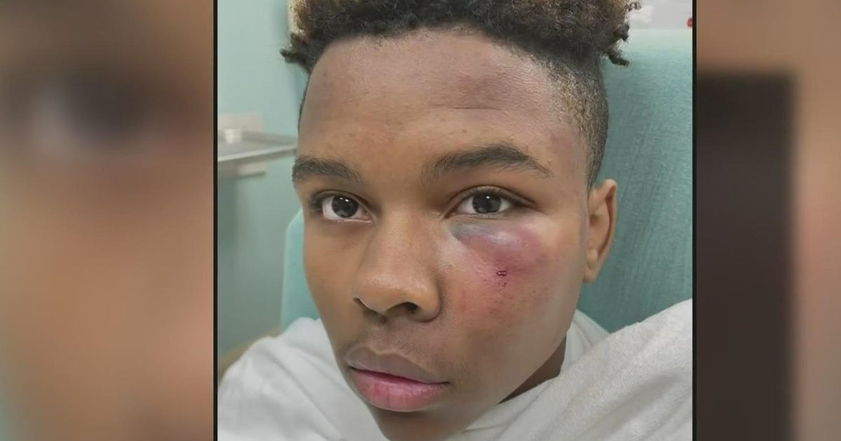 Substitute teacher charged with beating Waukegan boy - CBS Chicago
