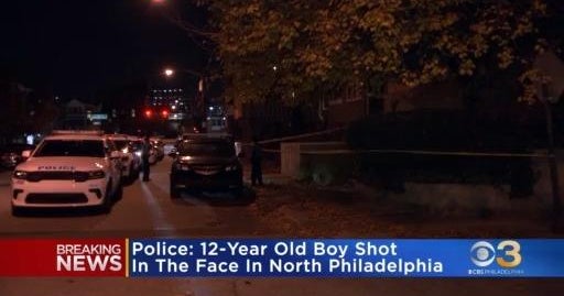 12-year-old boy shot twice in the face in North Philadelphia - CBS Philadelphia