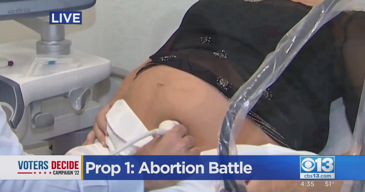 Prop 1 is a direct response to Roe v. Wade overturning - CBS Sacramento