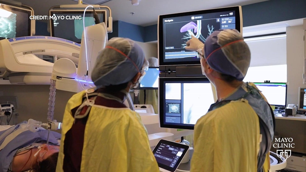 New Mayo Clinic procedure brings hope to patients with lung cancer ...