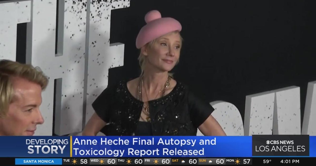Anne Heche's final autopsy and toxicology report released - CBS Los Angeles