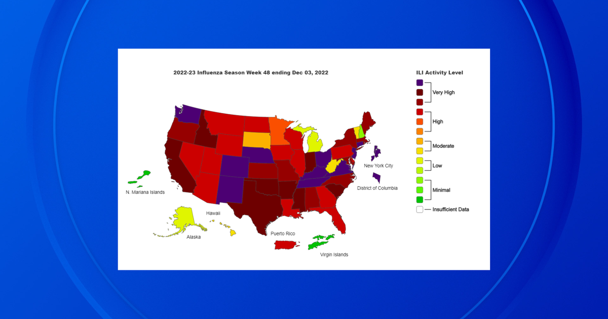 Michigan among states with low flu activity - CBS Detroit