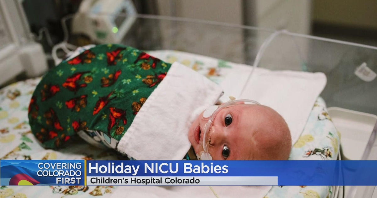 NICU babies all dressed up for the holidays at Children's Hospital ...