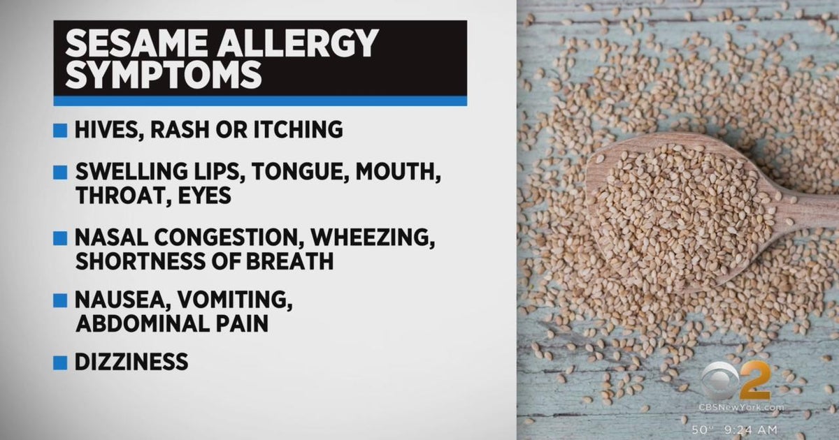 New law requires sesame allergy label - CBS New York