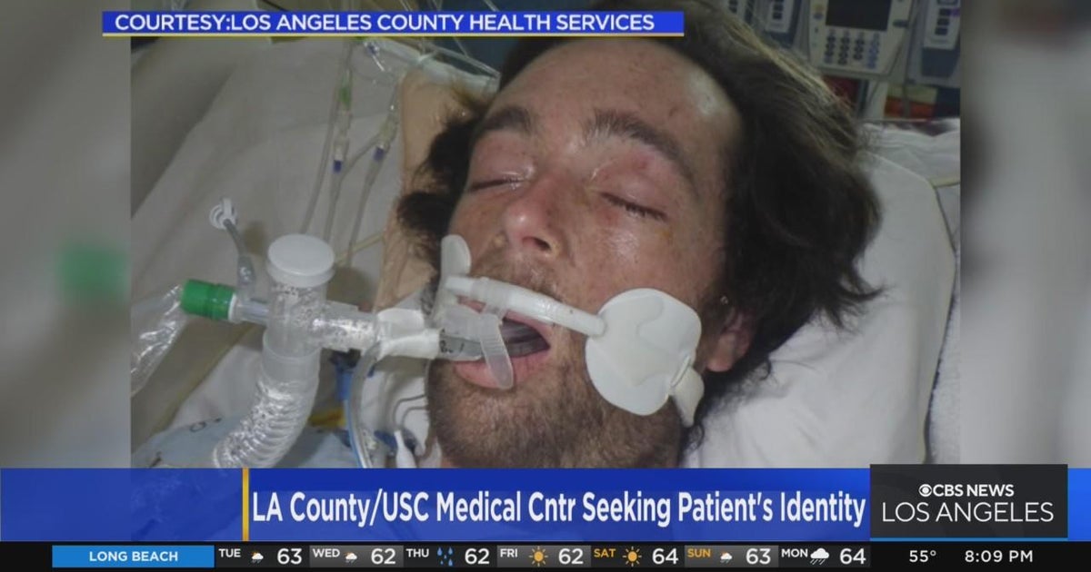 LAC+USC Medical Center seeking help in identifying unknown patient ...