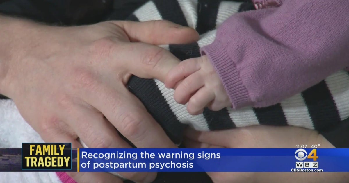 Recognizing the warning signs of postpartum psychosis - CBS Boston