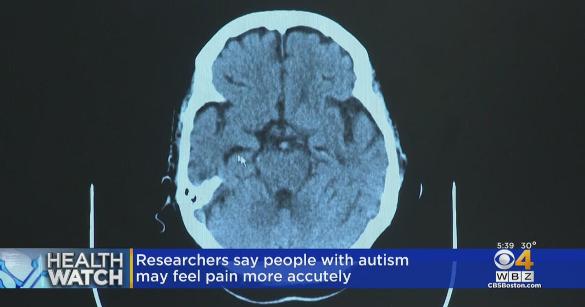 New Study Reveals People With Autism Are More Sensitive To Pain Cbs