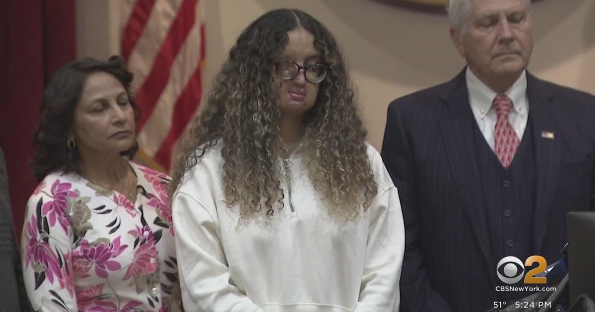 Reward increased in 2021 Long Island acid attack - CBS New York