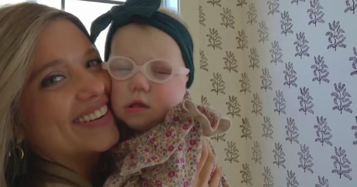 Family raises $100,000 to help find a cure for daughter born with rare ...